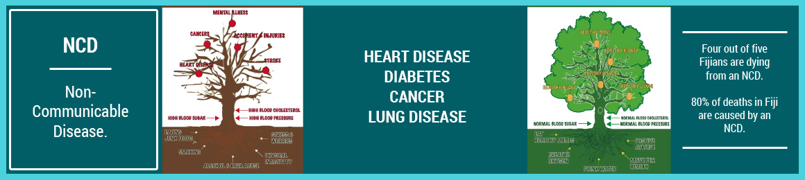 NCD | Ministry of Health and Medical Services